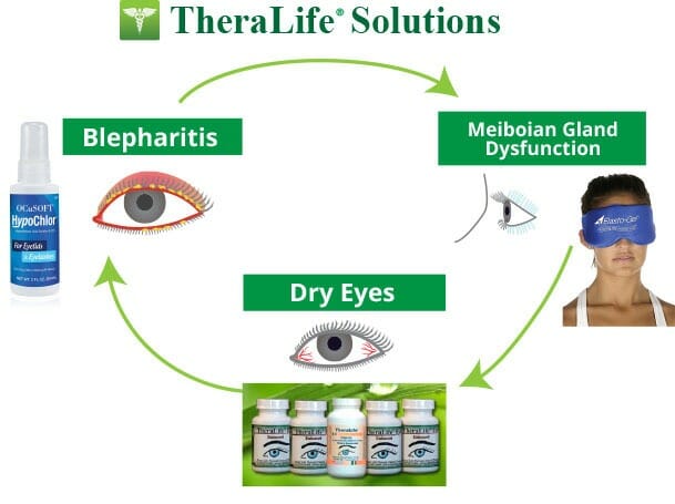 Blepharitis Treatment - Complete Recovery with TheraLife