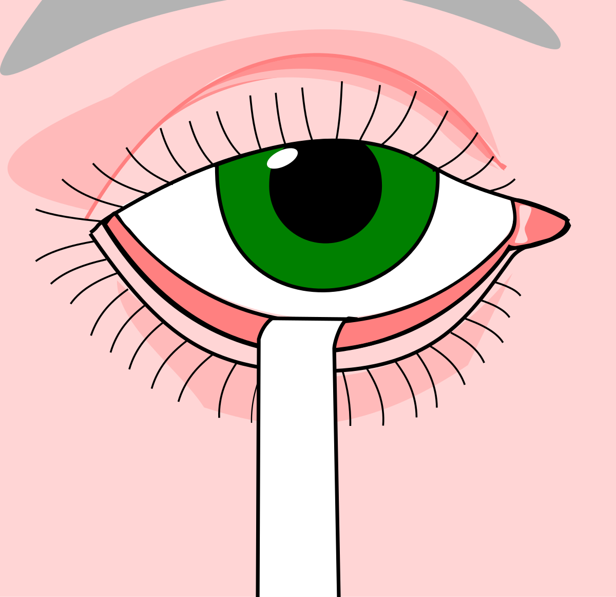 Best Dry Eye Diagnostic Test - Schirmer’s Test
