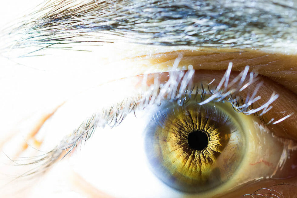 Powerful Relief For Crusty Eyes- With Natural Supplements